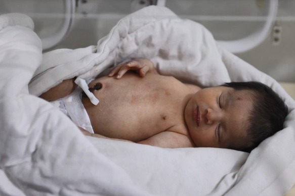 Thousands offer to adopt Syrian baby born amid devastating earthquake ...